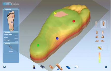 3D Laser Custom Orthotics - Entire Podiatry