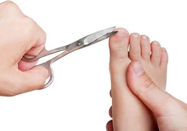Ingrown Toenail on a Newborn Baby, Toddler or Child - Entire Podiatry