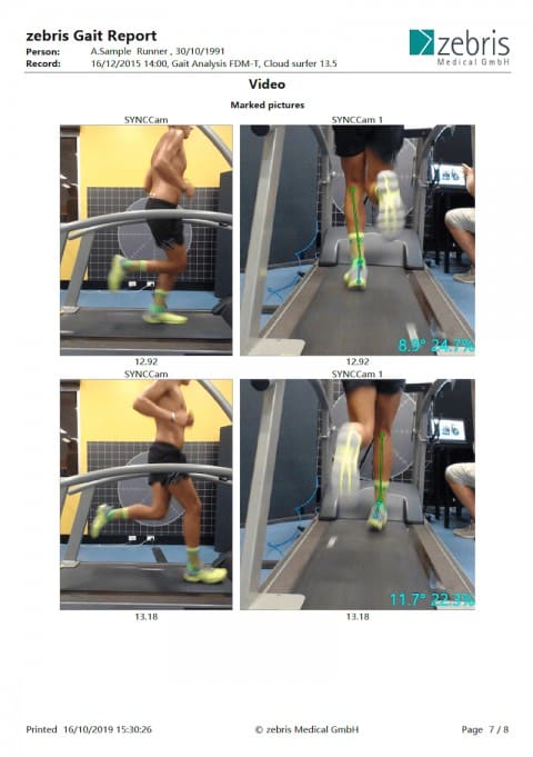 Biomechanical gait analysis - Entire Podiatry